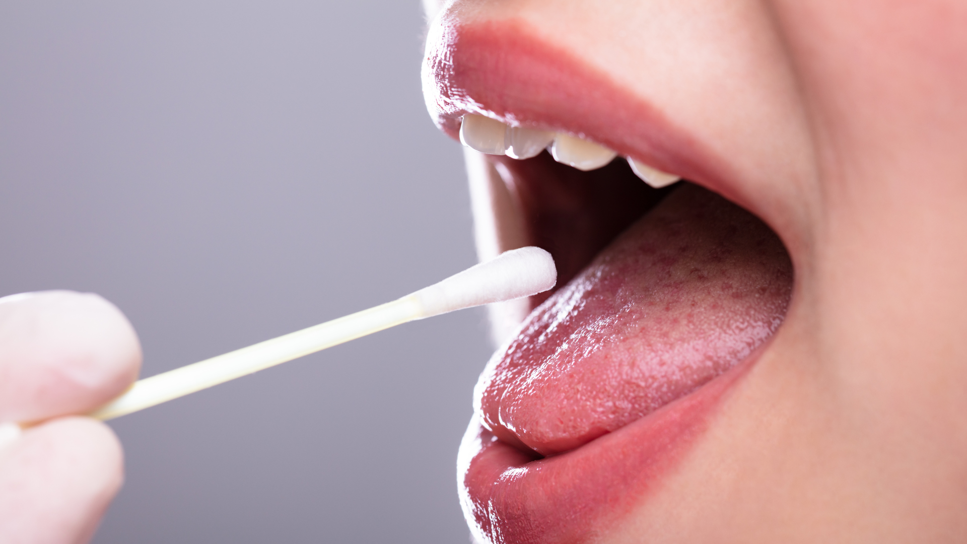 Saliva Drug Tests Canada | Oral Fluid Testing Kits - Spectrum MDX ...